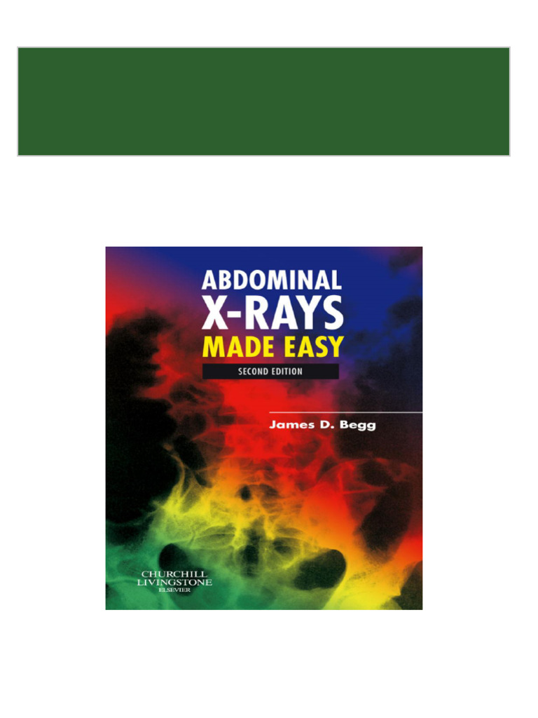 Full Abdominal X Rays Made Easy 2nd Edition Ebook All Chapters | PDF
