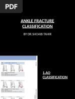 The Radiology Assistant - Ankle Fracture - Weber and Lauge-Hansen ...