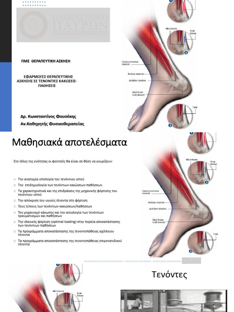 ΤΕΝΟΝΤΙΕΣ ΚΑΚΩΣΕΙΣ-ΠΑΘΗΣΕΙΣ | PDF