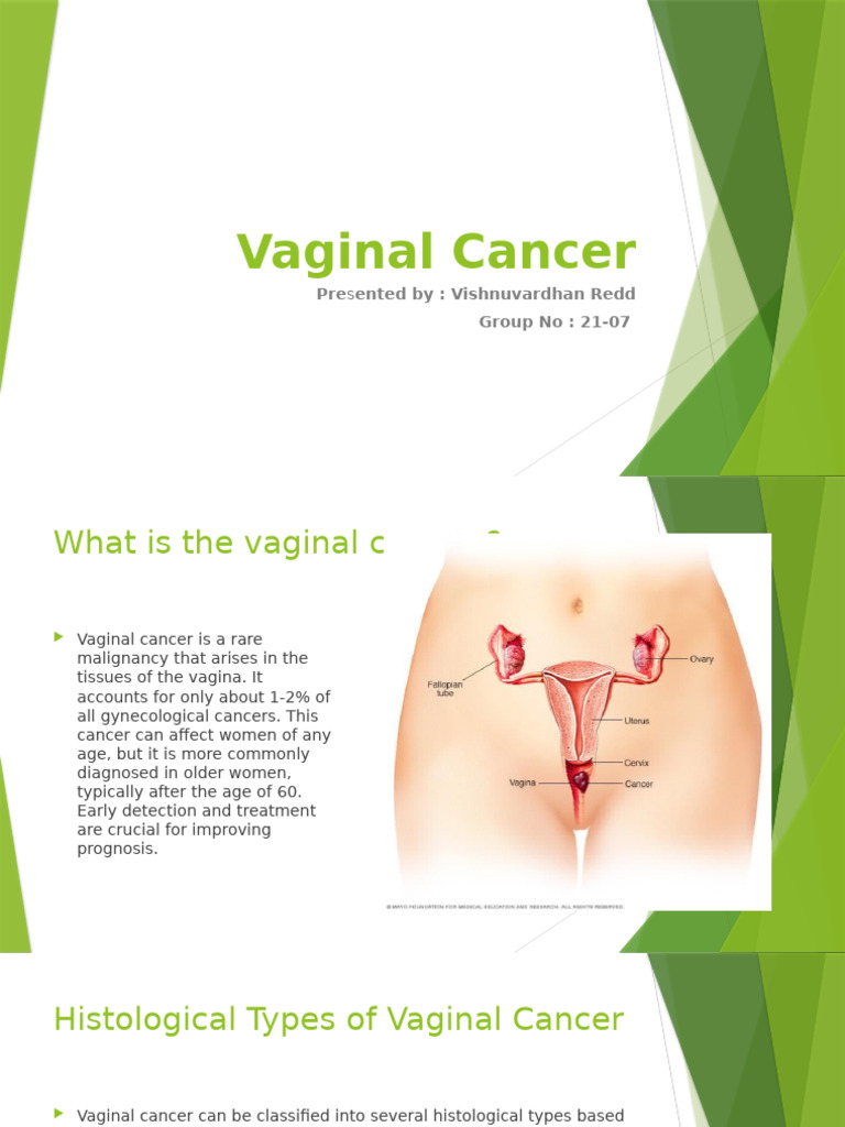 Vishnuvardhan Reddy (V C) | PDF | Cancer | Vagina