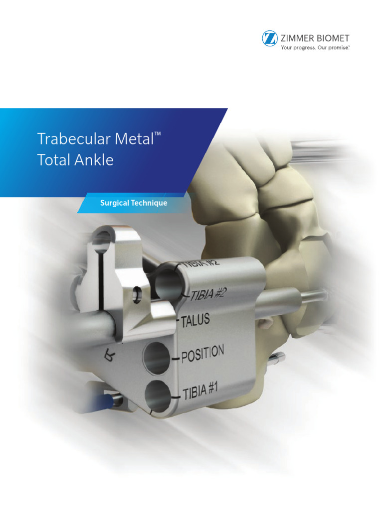 Trabecular Metal Total Ankle Surgical Technique | PDF | Ankle | Foot