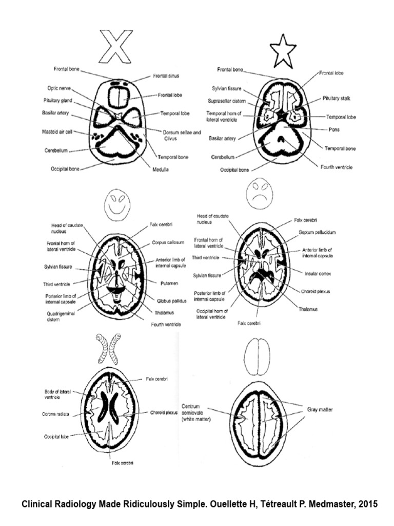 Understanding Cranial CT Scans | PDF