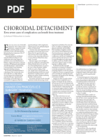 Understanding White Without Pressure (WWOP) | PDF | Vision | Ophthalmology