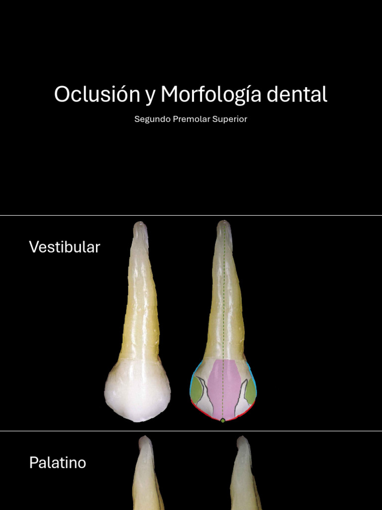 Segundo premolar superior | PDF