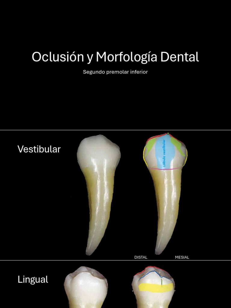 Segundo Premolar Inferior | PDF