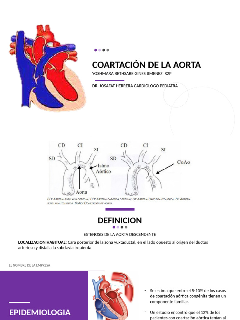 CoartaciÓn de LA AortA | PDF | Insuficiencia cardíaca | Sistema cardiovascular