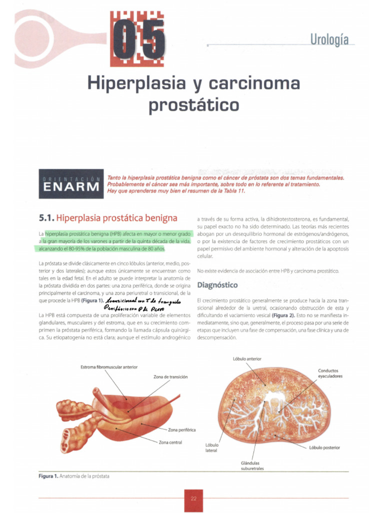 HPB y Cáncer de Próstata | PDF | Antígeno específico de la próstata ...