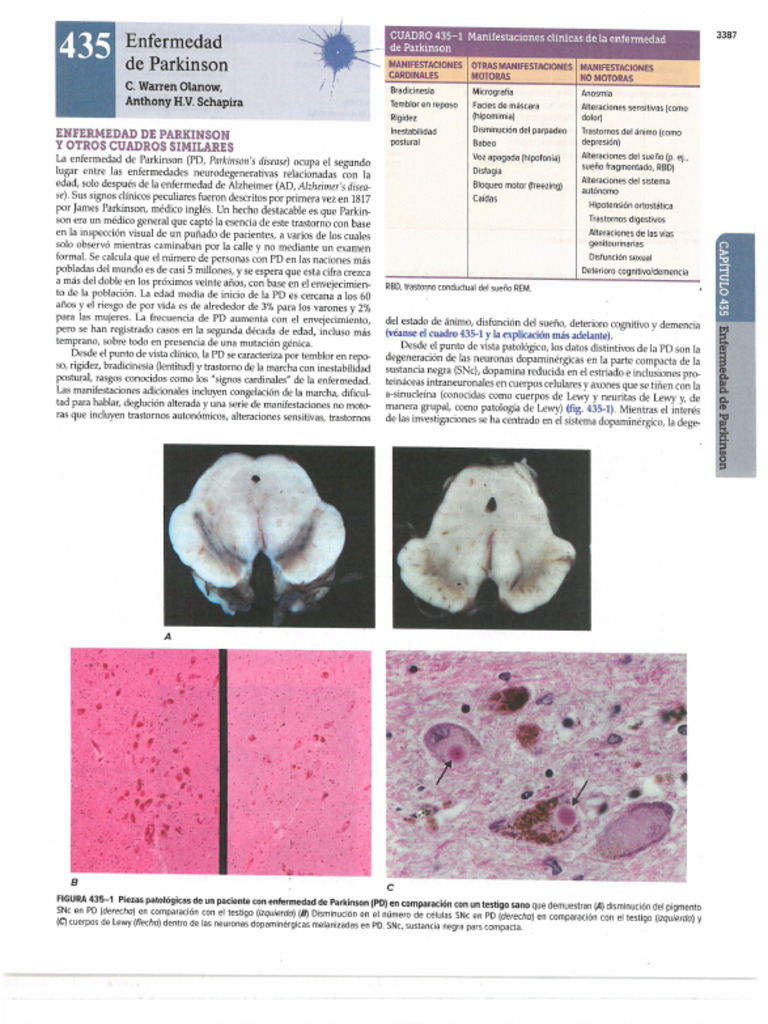 Extrapiramidales Harrison 21 | PDF
