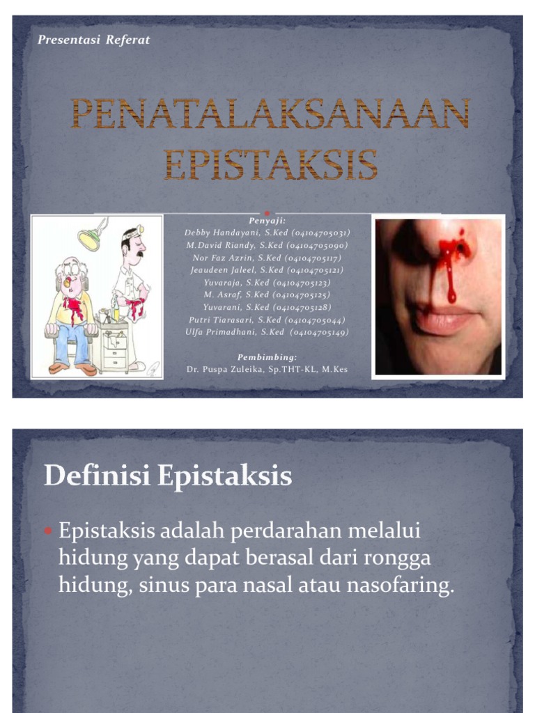 Penatalaksanaan Epistaksis | PDF