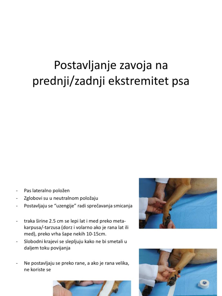 Postavljanje Zavoja | PDF
