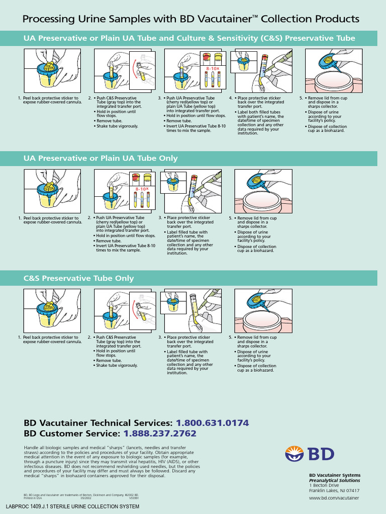 Urine Sample Processing BD Cup-1 | PDF | Medical Specialties | Clinical Medicine