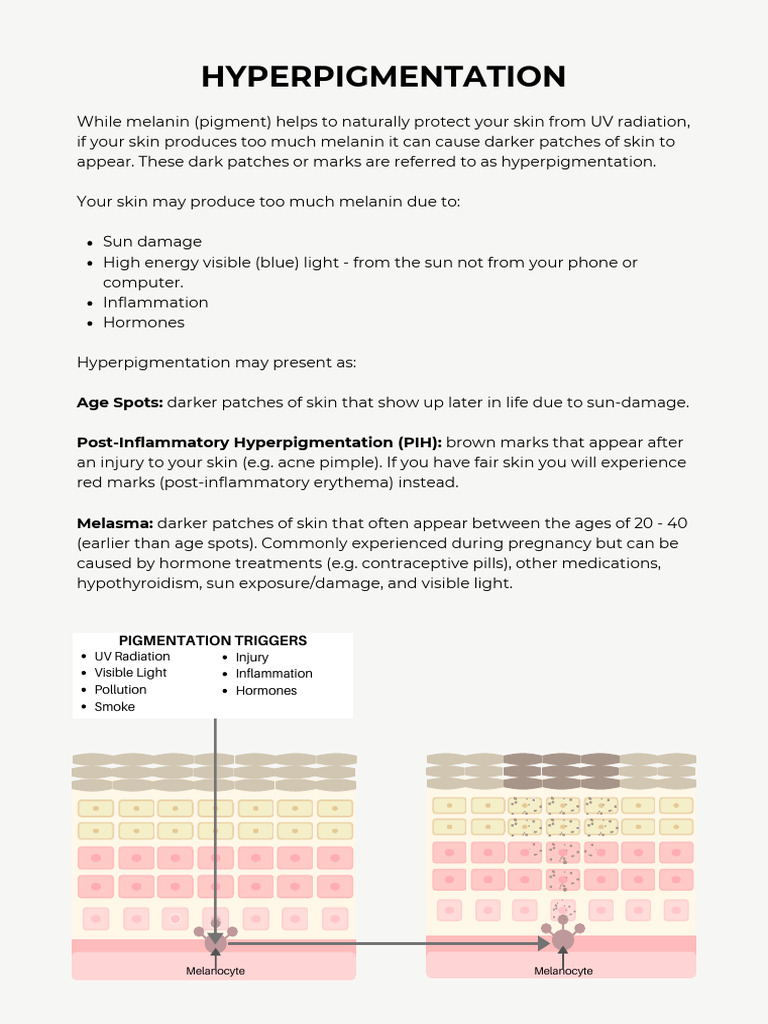 Pigmentation Handout | PDF | Sunscreen | Ultraviolet