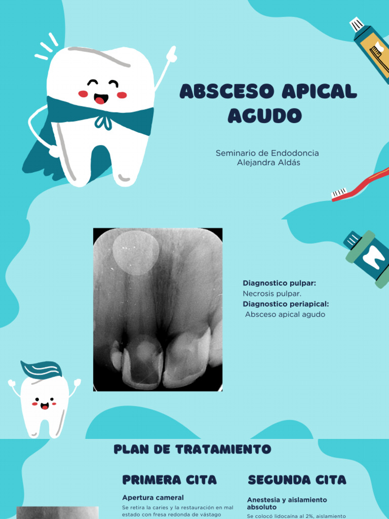 Absceso apical agudo | PDF