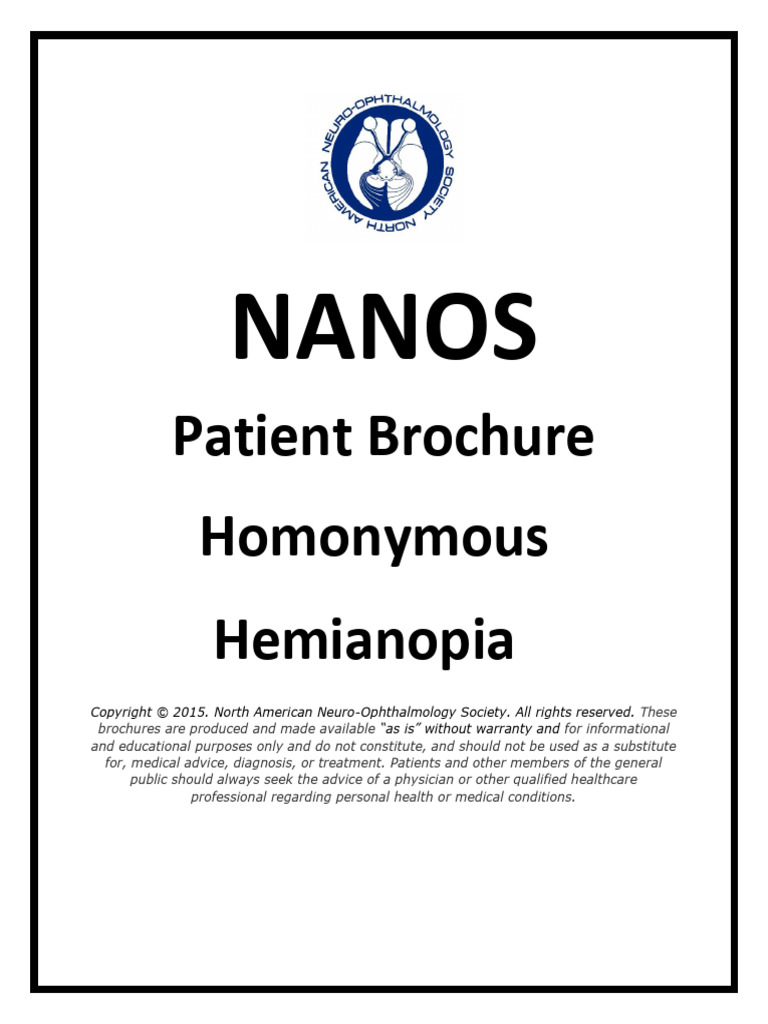 Homonymous Hemianopia Tagalog Edited | PDF