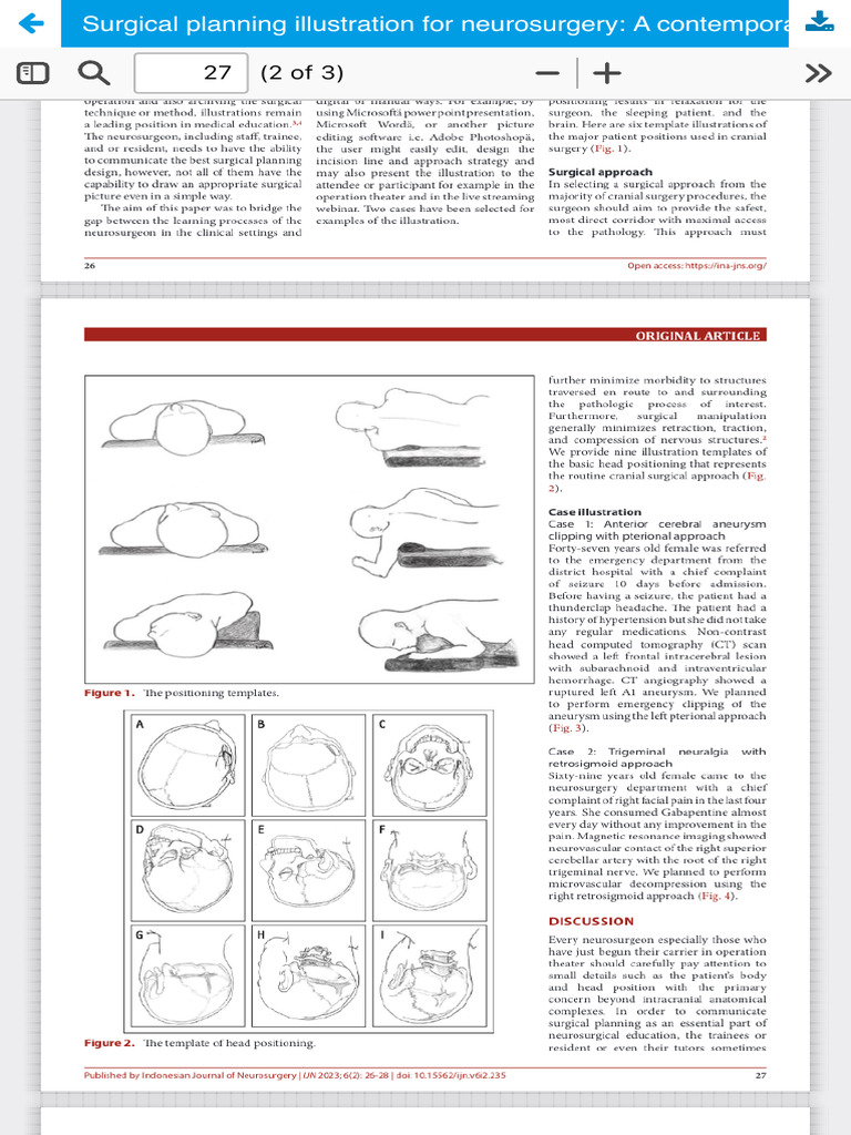 View of Surgical Planning Illustration For Neurosurgery A Contemporary ...