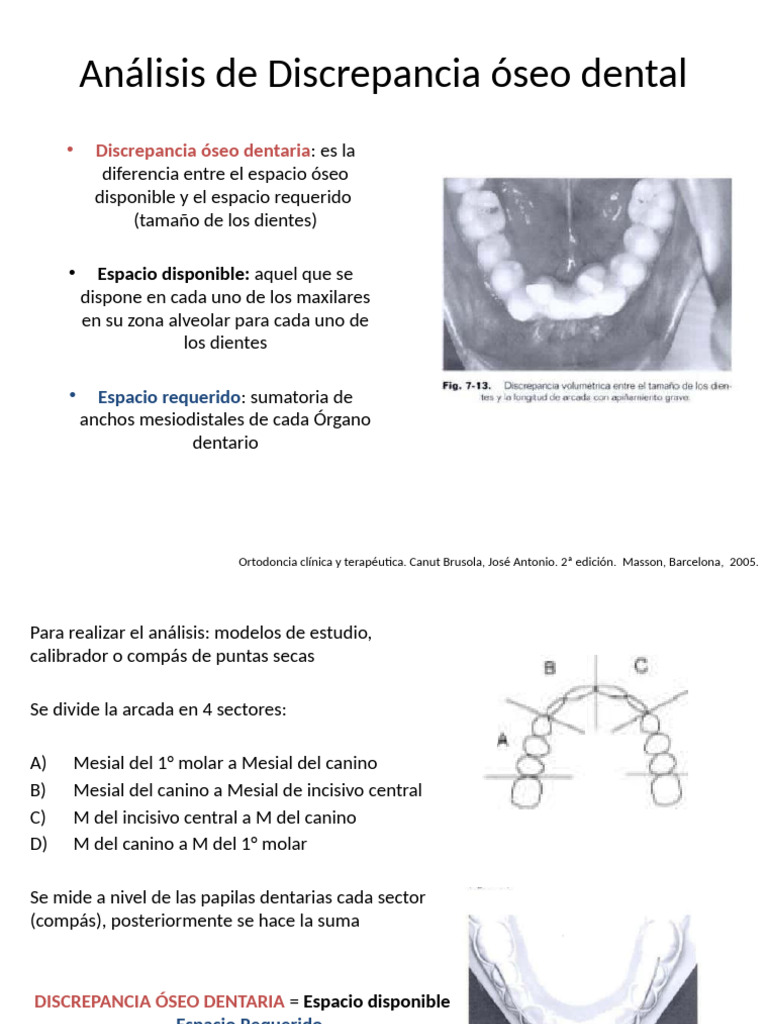 5.1discrepancia Óseo Dental | PDF | Ortodoncia | Diente