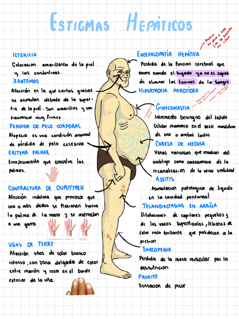 Estigmas Hepaticos | PDF | Especialidades Medicas | Medicina CLINICA