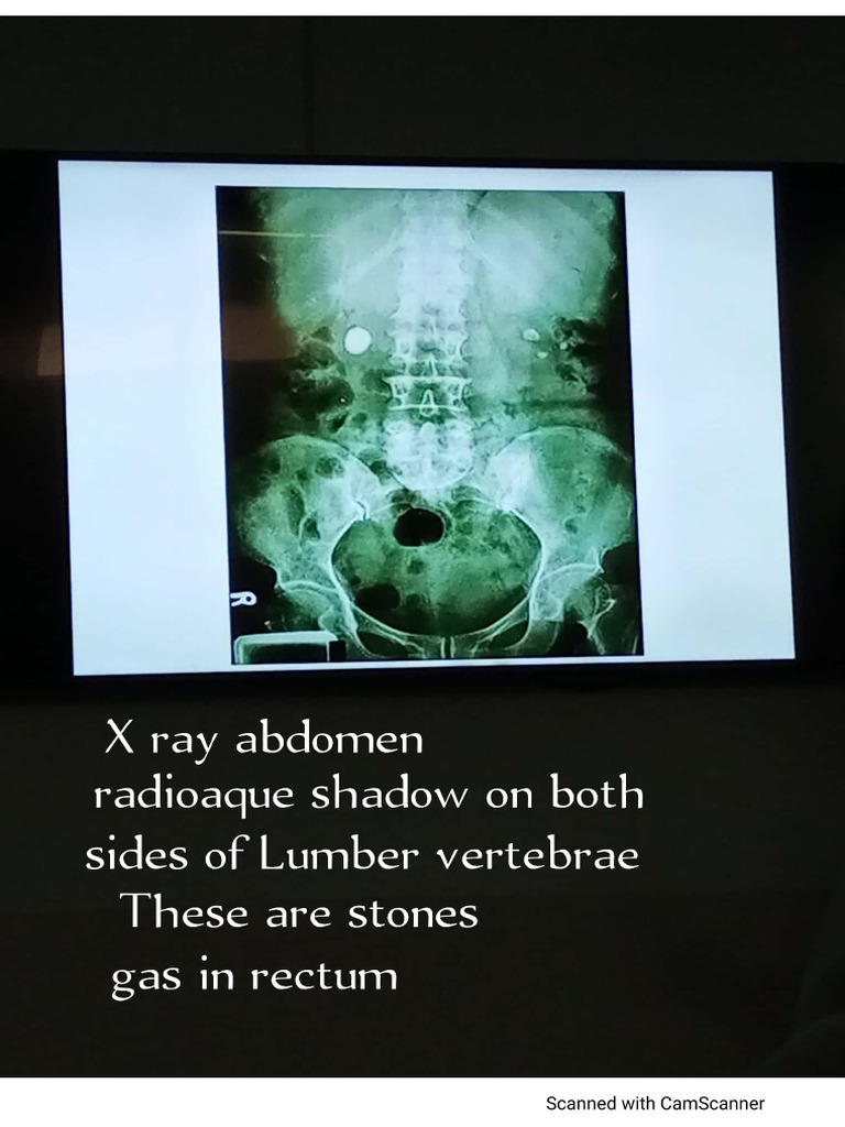 X-Ray Identification (General Surgery) | PDF