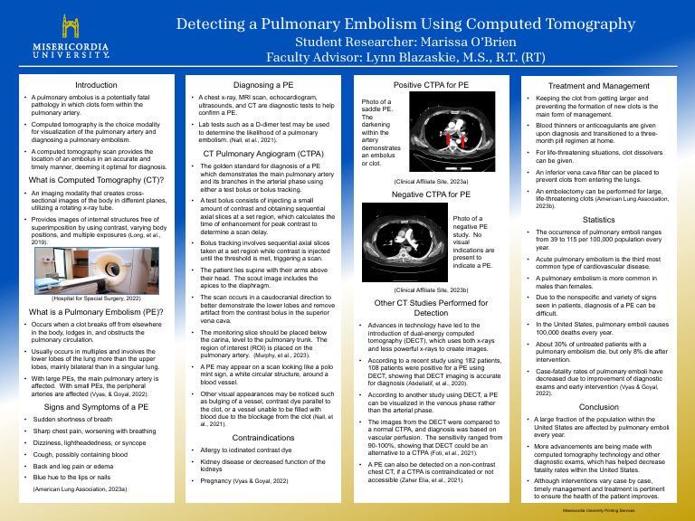 Detecting A Pulmonary Embolism Using Computed Tomography | PDF | Ct Scan | Causes Of Death