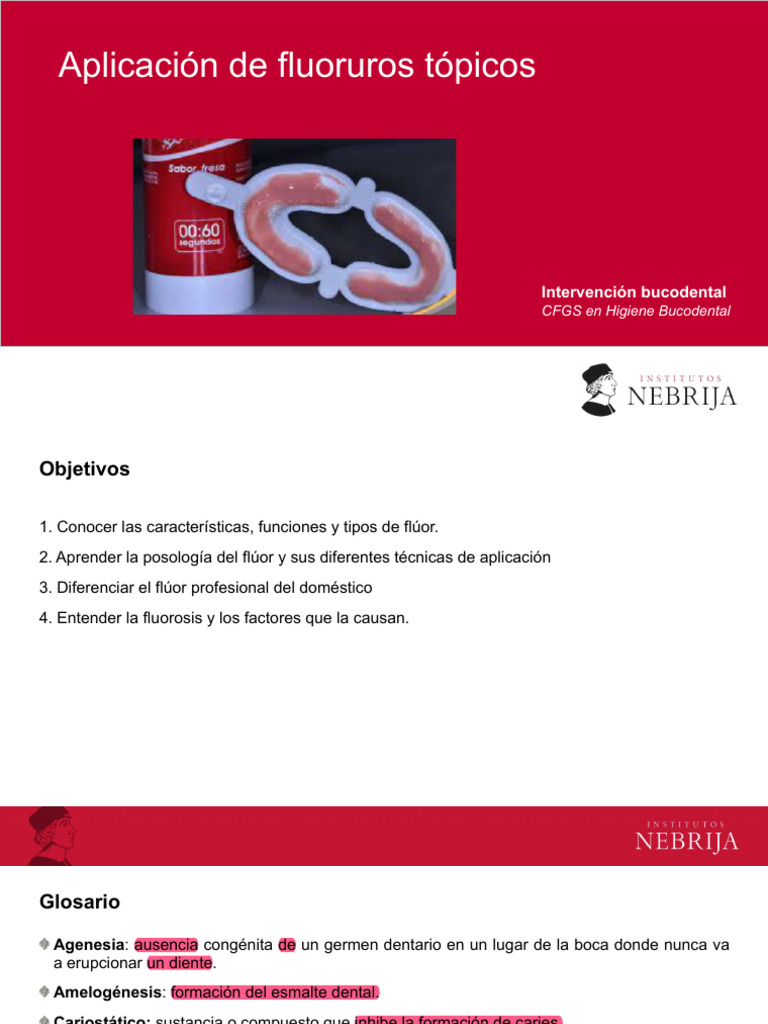 Aplicación de Fluoruros Tópicos. UD2 | PDF | Flúor