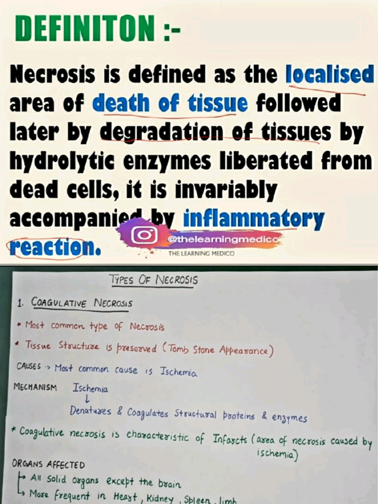 Types of Necrosis | PDF