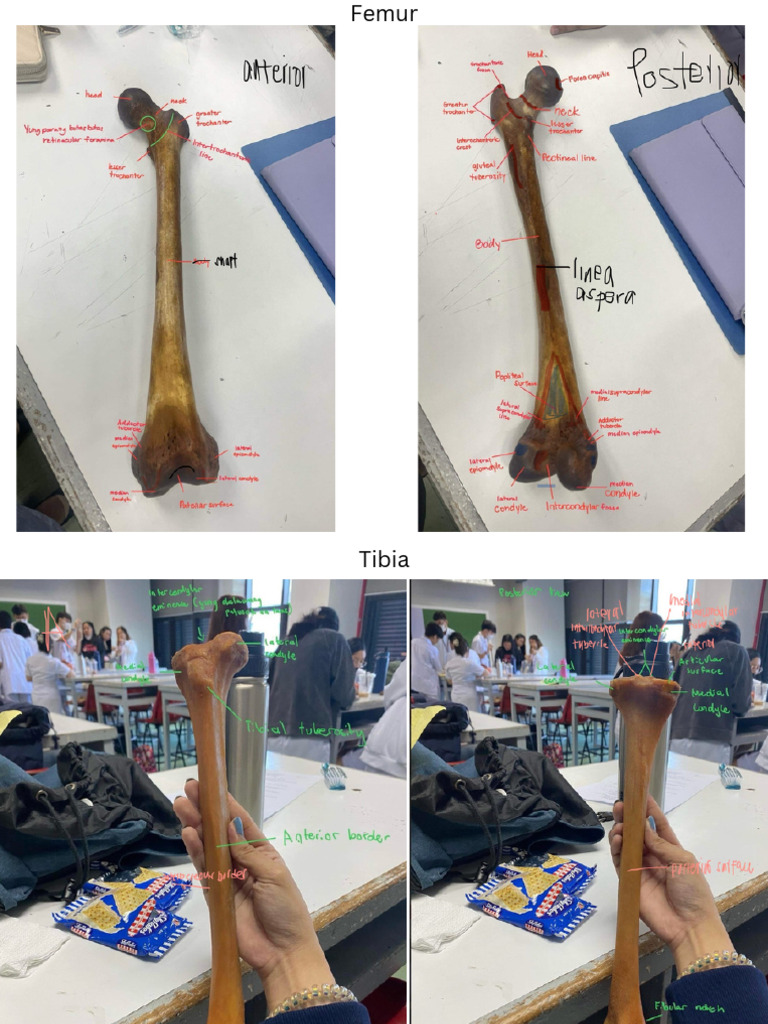 Femur PDF | PDF