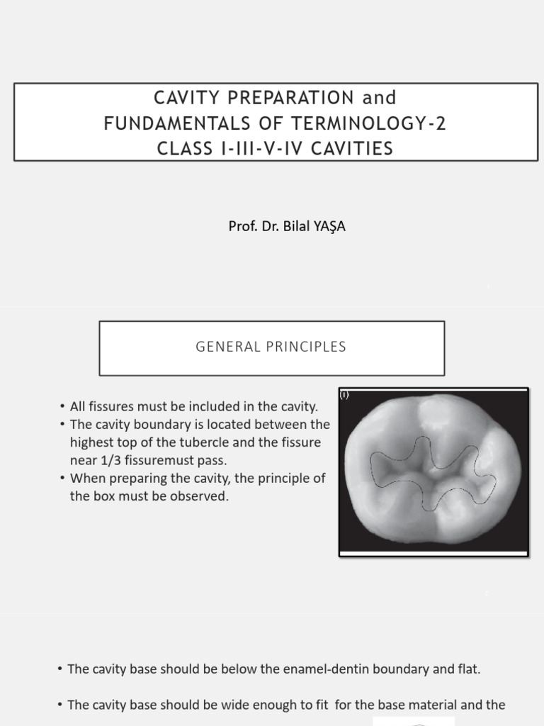 Cavity Preparations Class I, V, VI | PDF | Tooth Enamel | Human Tooth