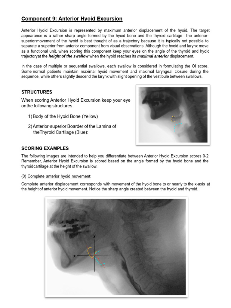Anterior Hyoid Excursion Guide | PDF | Larynx | Thyroid