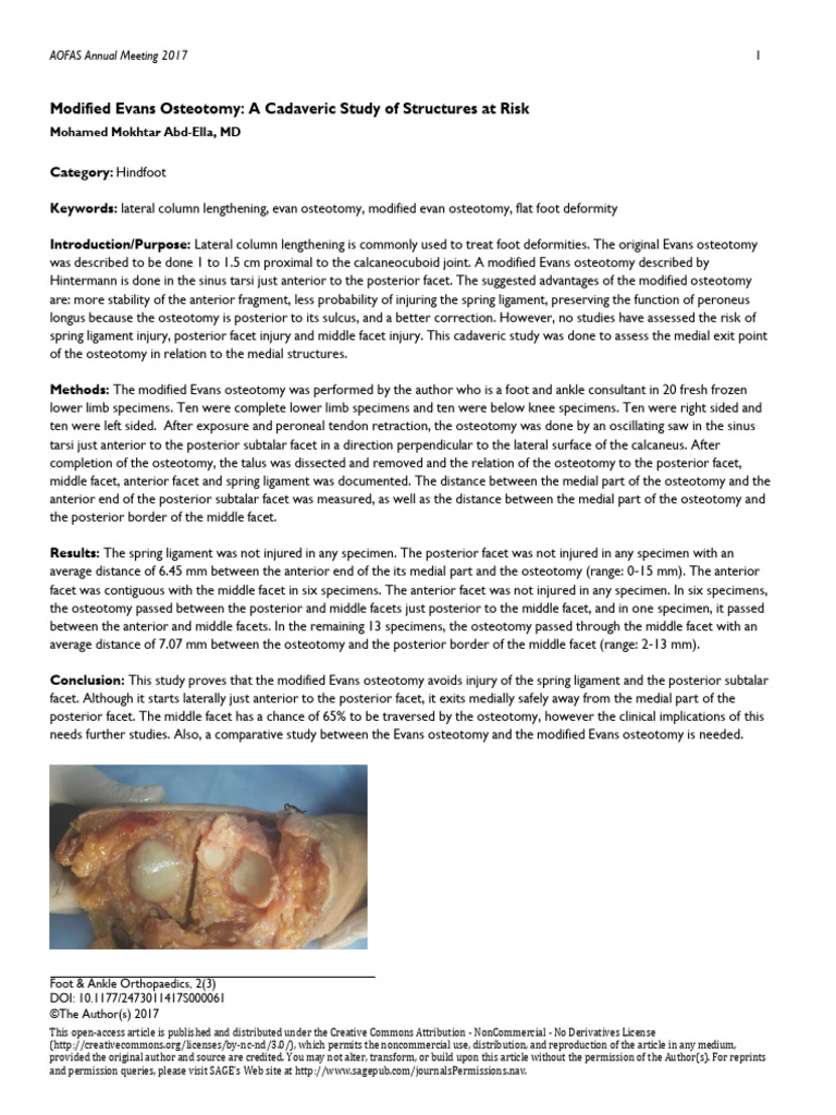 Modified Evans Osteotomy A Cadaveric Study of Stru | PDF | Foot | Ankle