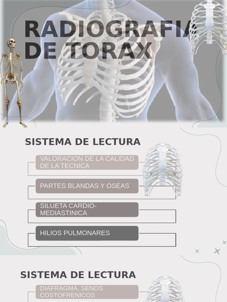 RX de Torax | PDF | Pulmón | Sistema respiratorio