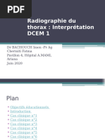 Plan D'interpretation D'une Radiographie Du Thorax | PDF | Thorax | Poumon