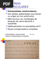 Trigeminismo Ventricular: Definición y Tratamiento | PDF