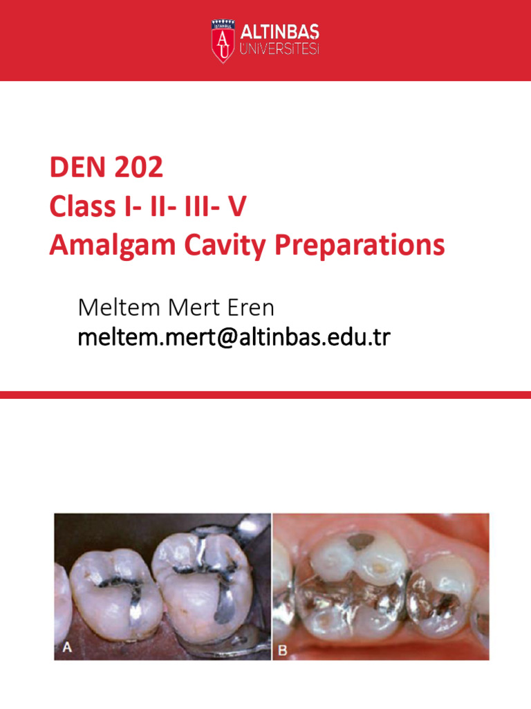5 - Amalgam Cavity Preparations | PDF | Tooth Enamel | Dental Anatomy