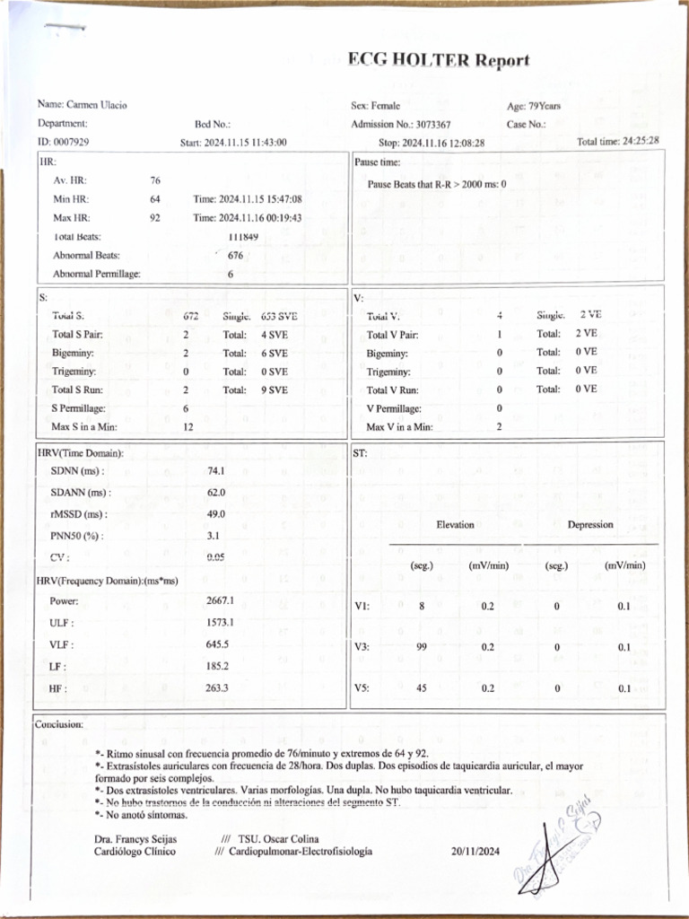ECG HOLTER Report | PDF ECG HOLTER Report | PDF
