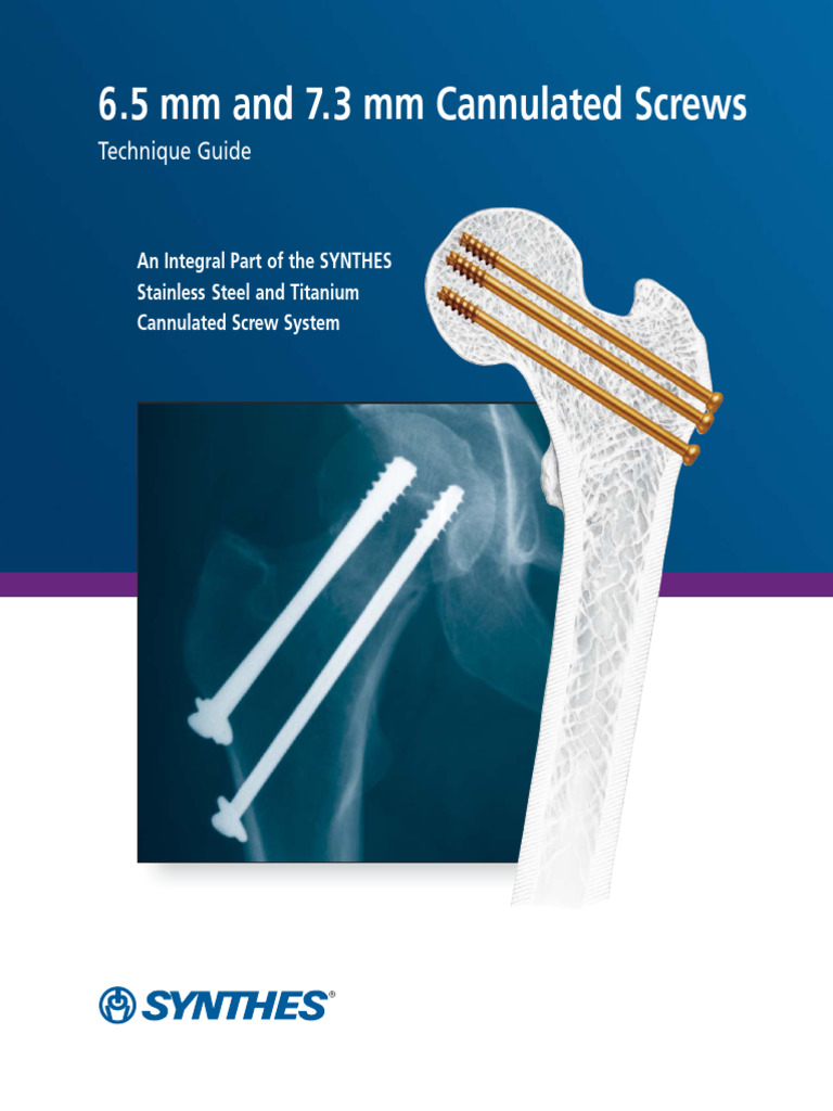 CSS 6.5-7.3 - Técnica Cirúrgica SUSA | PDF | Screw