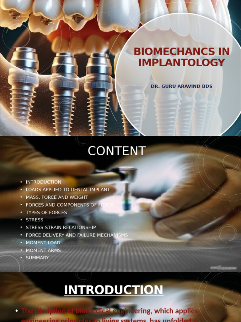 Biomechanics in Dental Implantology | PDF | Dental Implant | Deformation (Engineering)