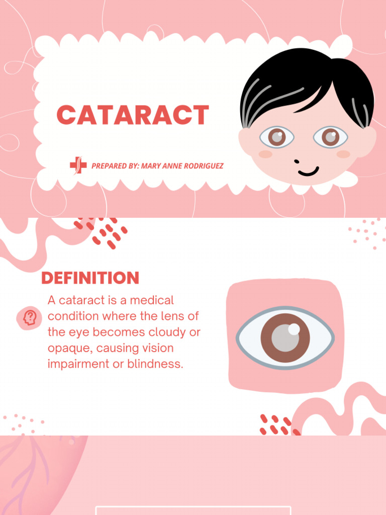 Cataract | PDF