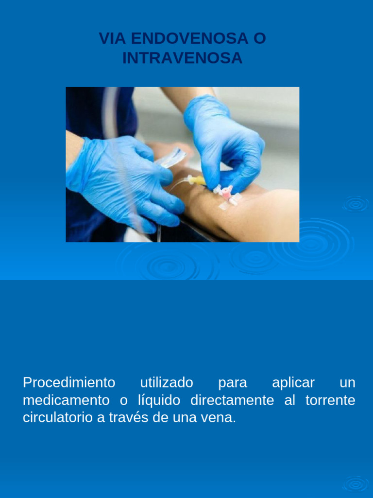 Via Endovenosa O Intravenosa | PDF | Terapia intravenosa | Tratamientos ...