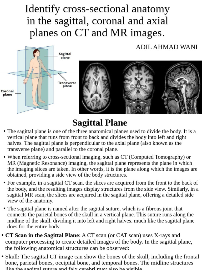 Identify Cross-Sectional Anatomy | PDF | Abdomen | Vertebral Column