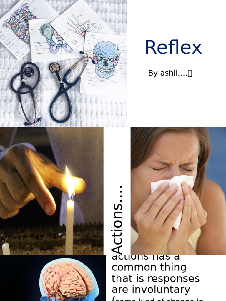 Reflex | PDF