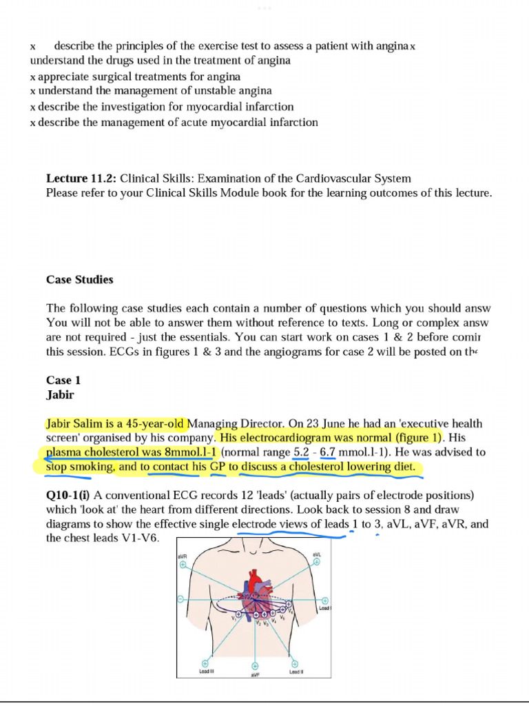 Cvs Session 10 Sgd | PDF | Coronary Artery Disease | Heart