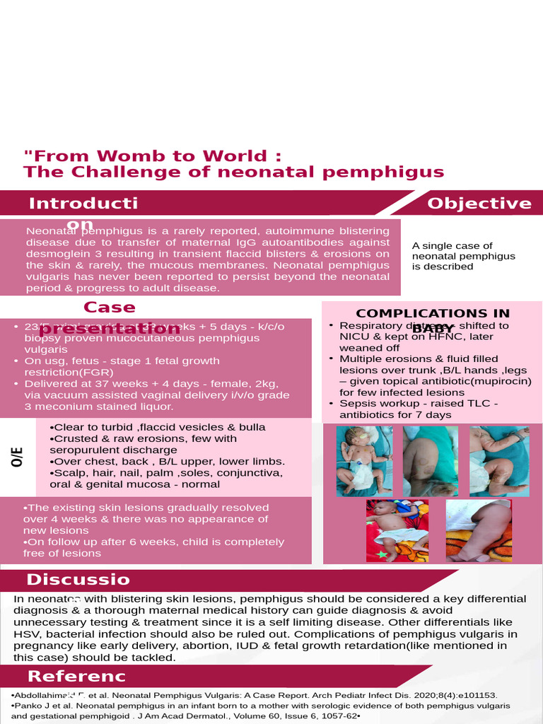 Eposter Neonatal Pemphigus | PDF | Human Reproduction | Immunology