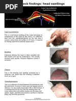 Sacral Dimple Guidelines for Neonates | PDF | Clinical Medicine ...