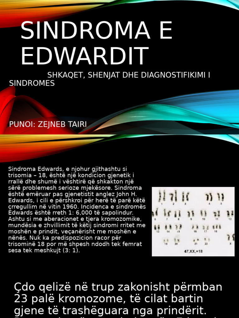 Sindroma Edward | PDF