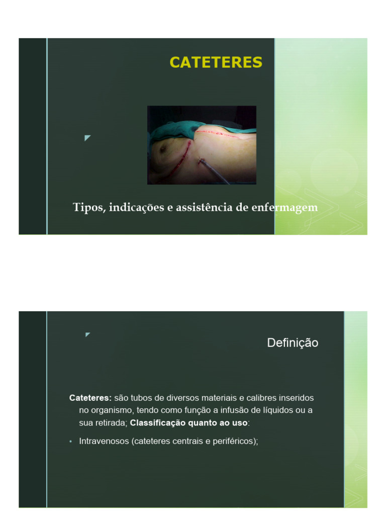 Aula 5 - Cateteres Centrais e Periféricos | PDF | Veia | Especialidades ...