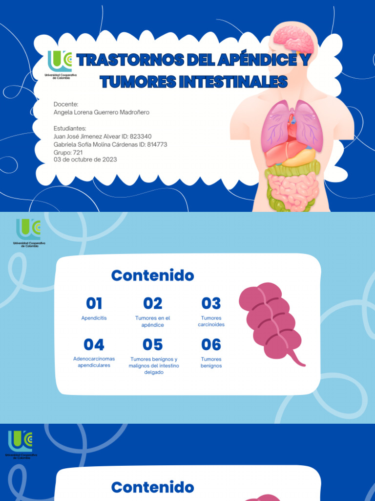 Trastornos Del Apéndice y Tumores Intestinales | PDF