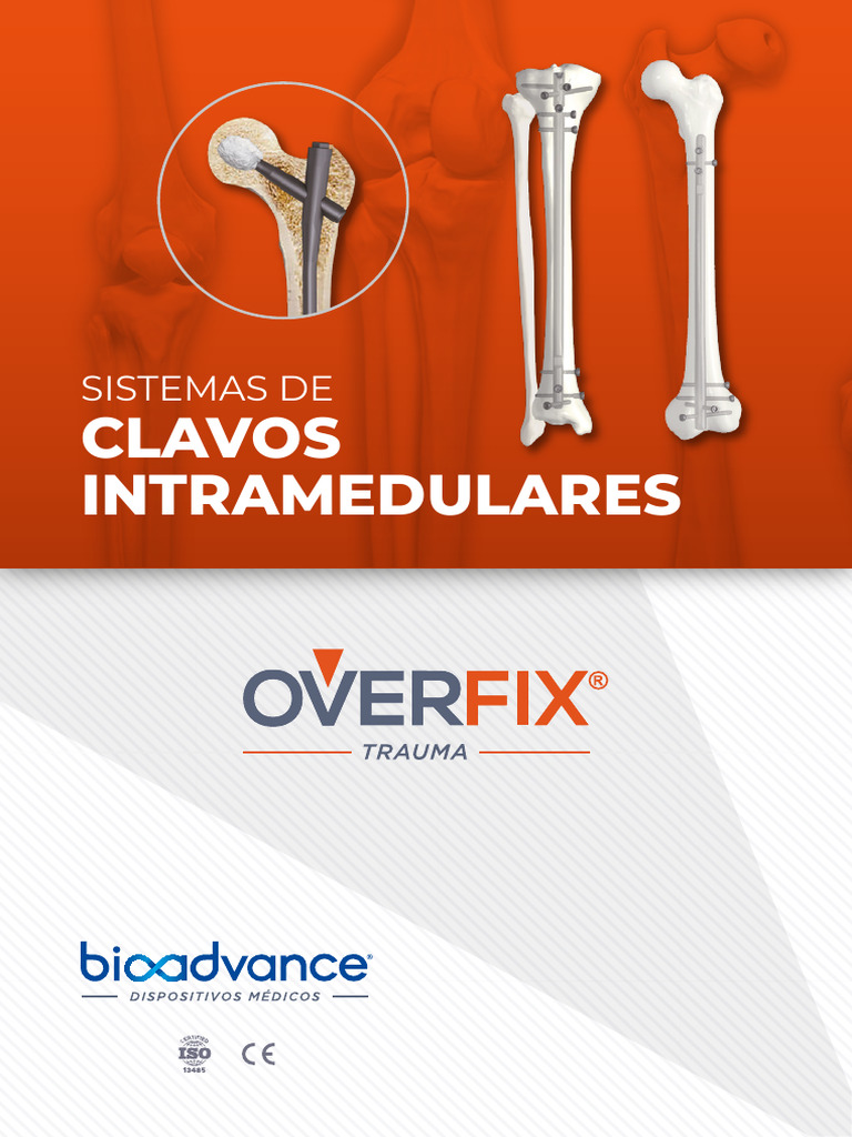 Clavos Intramedulares para Fracturas | PDF | Hueso | Sistema esquelético