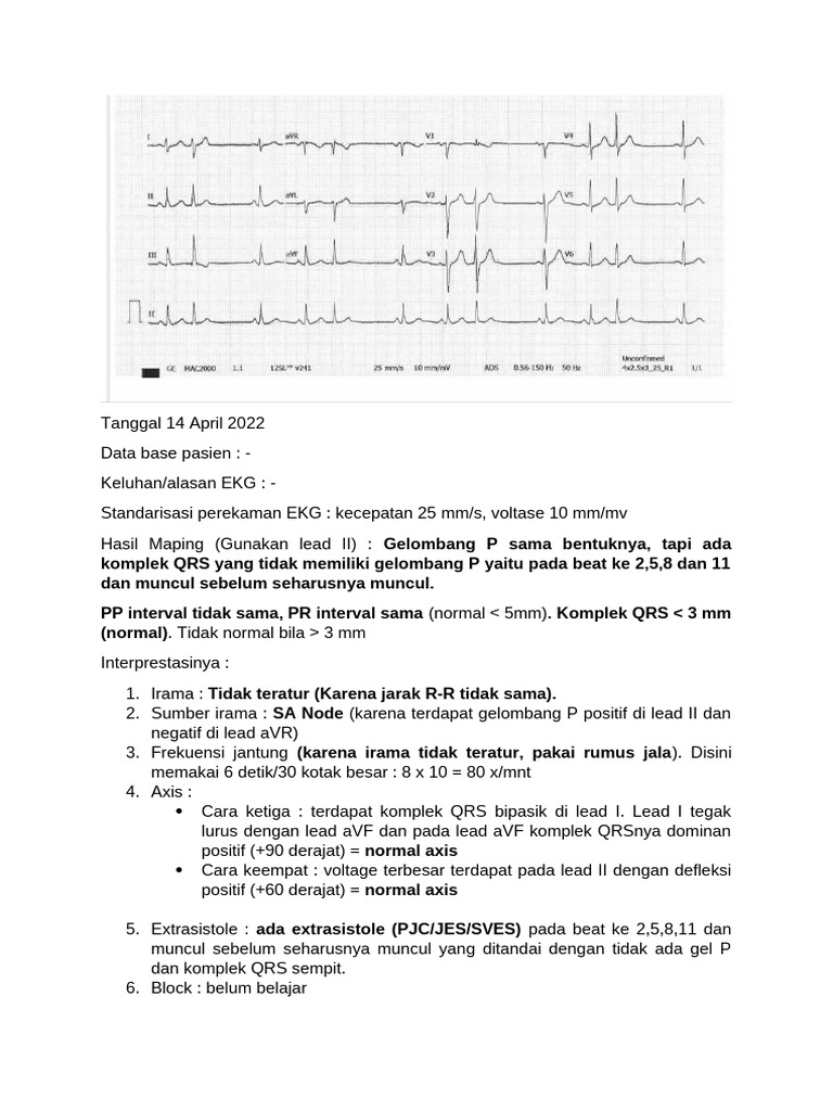 Latihan Interpretasi EKG TGL 14 April 2022 | PDF