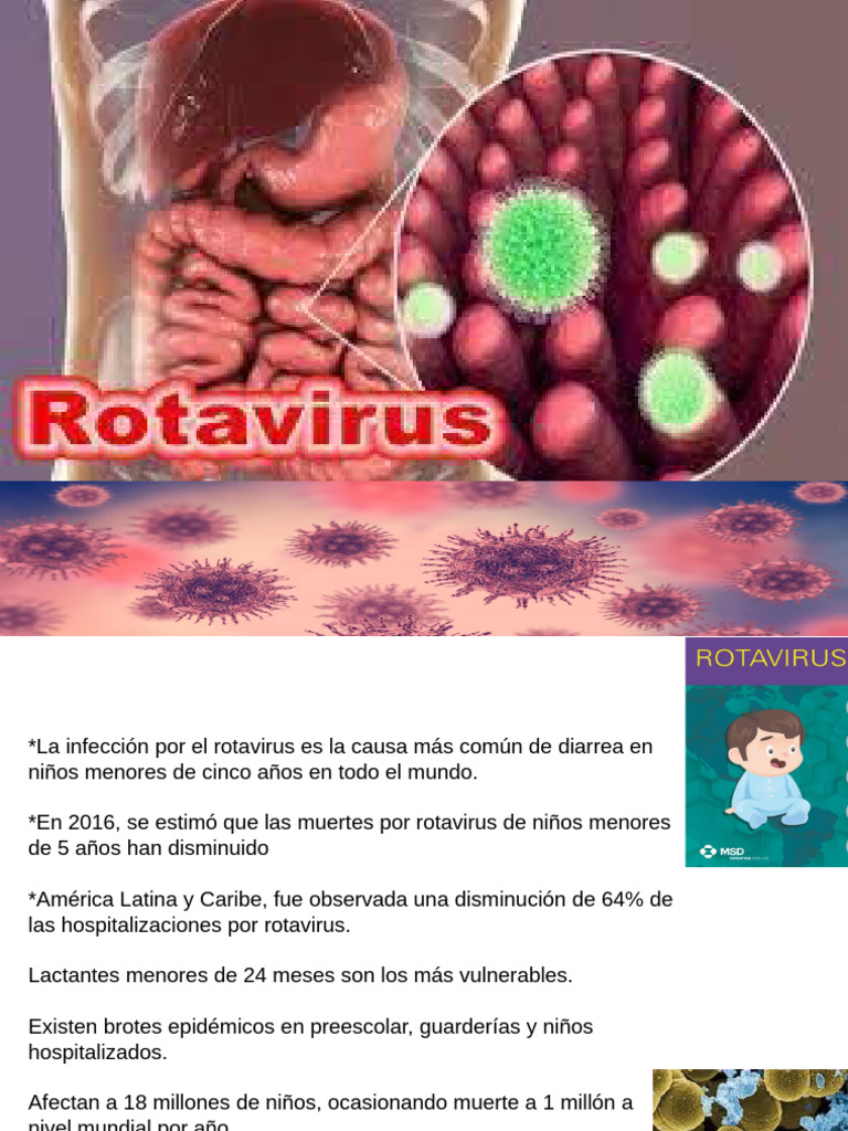 Rotavirus Presentacion | PDF | Diarrea | Sistema inmune