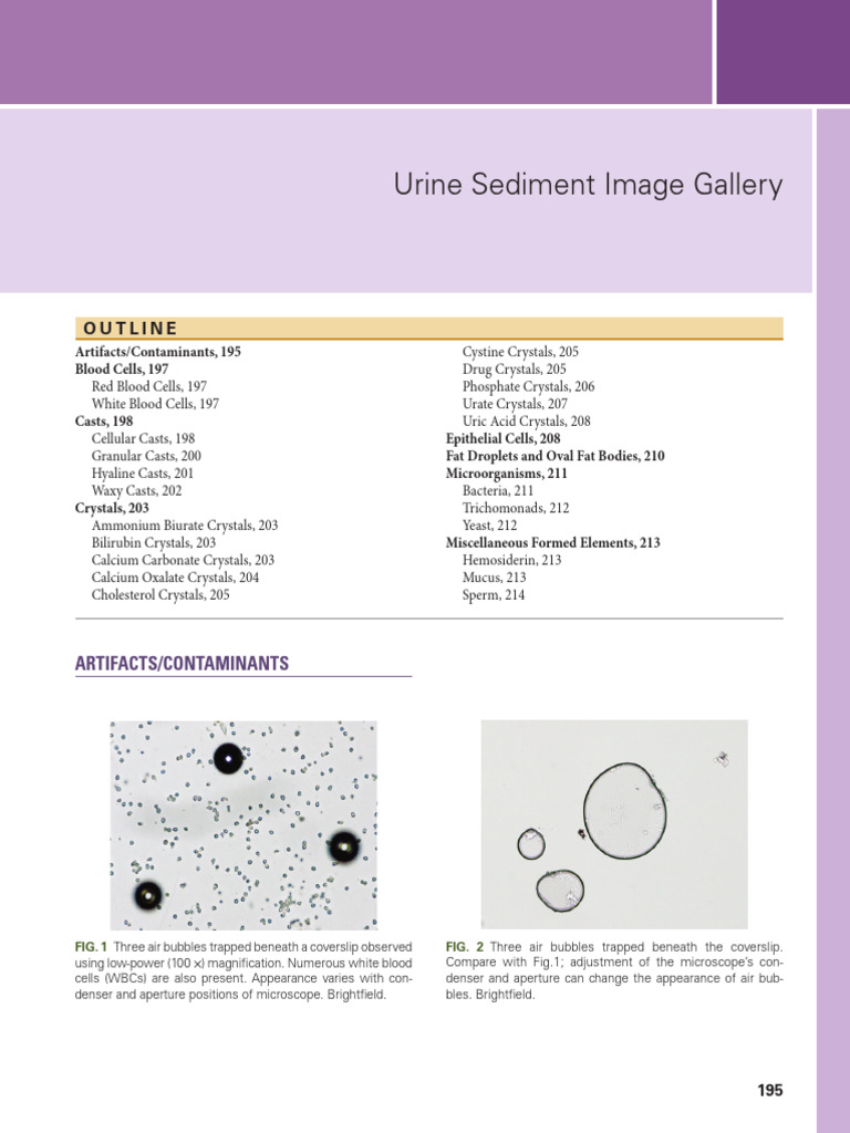 Fundamentals of Urine and Body Fluid Analysis - Ebook (Fifth Edition ...